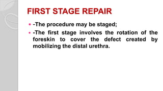 Epispadial repair | PPT