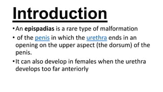 Epispadias 131104120306-phpapp01 (1) | PPT