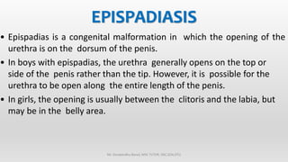 EPISPADIAS (CONGENITAL ANOMALY OF GENITOURINARY SYSTEM) | PPTX