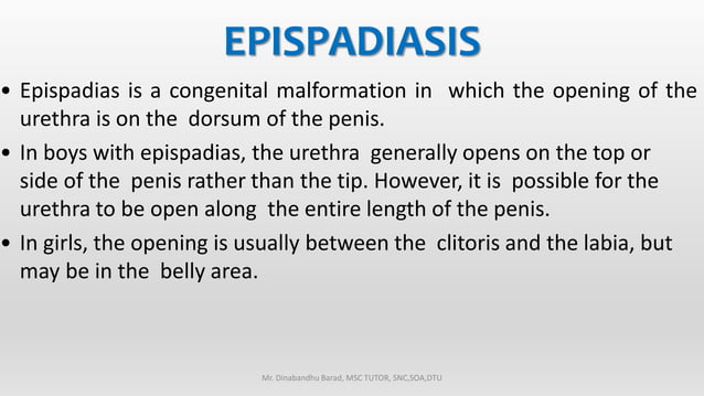 EPISPADIAS (CONGENITAL ANOMALY OF GENITOURINARY SYSTEM) | PPT