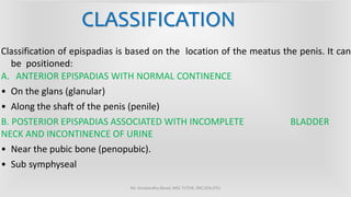 EPISPADIAS (CONGENITAL ANOMALY OF GENITOURINARY SYSTEM) | PPTX