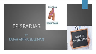 EPISPADIAS.pptx