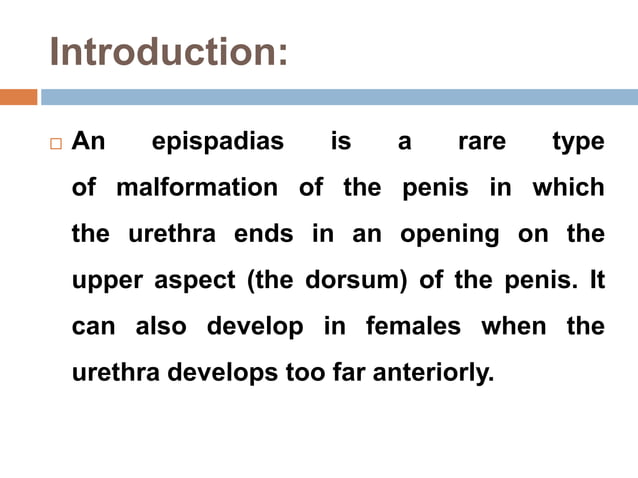 Epispadiasis | PPTX | Sexual Conditions | Sexual Health