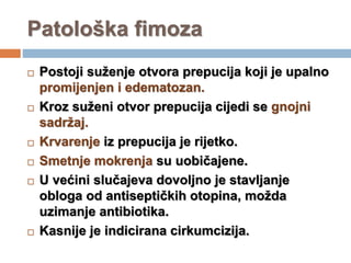 Epispadija, hipospadija | PPT
