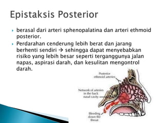 penegakan diagnosis dan tatalaksana epistaksis | PPTX
