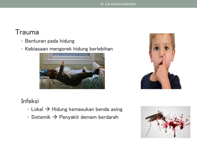 epistaksis mimisan untuk bahan penyuluhan | PPT
