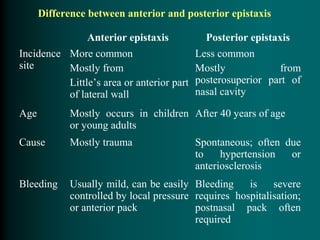 Epistaxis | PPT