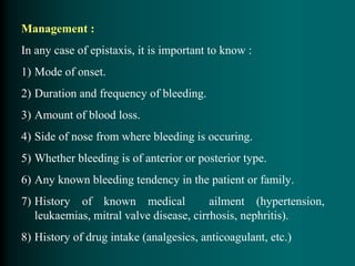 Epistaxis | PPT