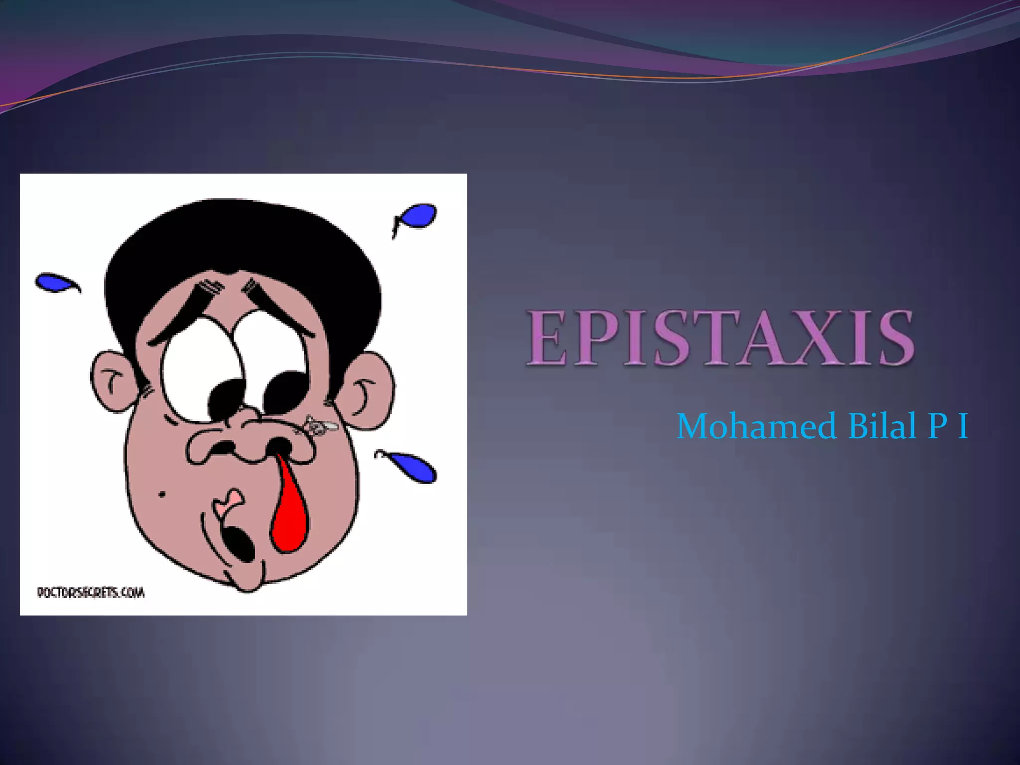 Epistaxis | PPTX