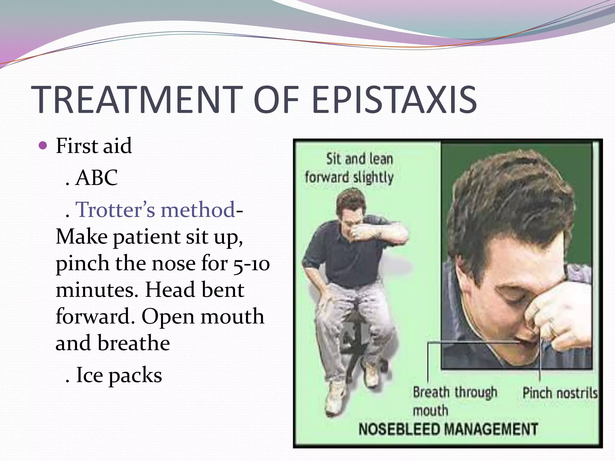 Epistaxis | PPTX