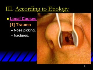 Epistaxis | PPTX