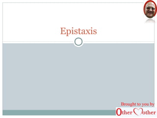 Epistaxis | PPT