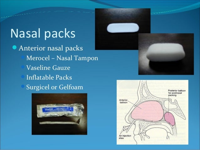 Epistaxis- Nose Bleed Overview and Managment