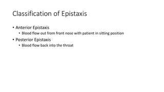 Epistaxis | PPTX