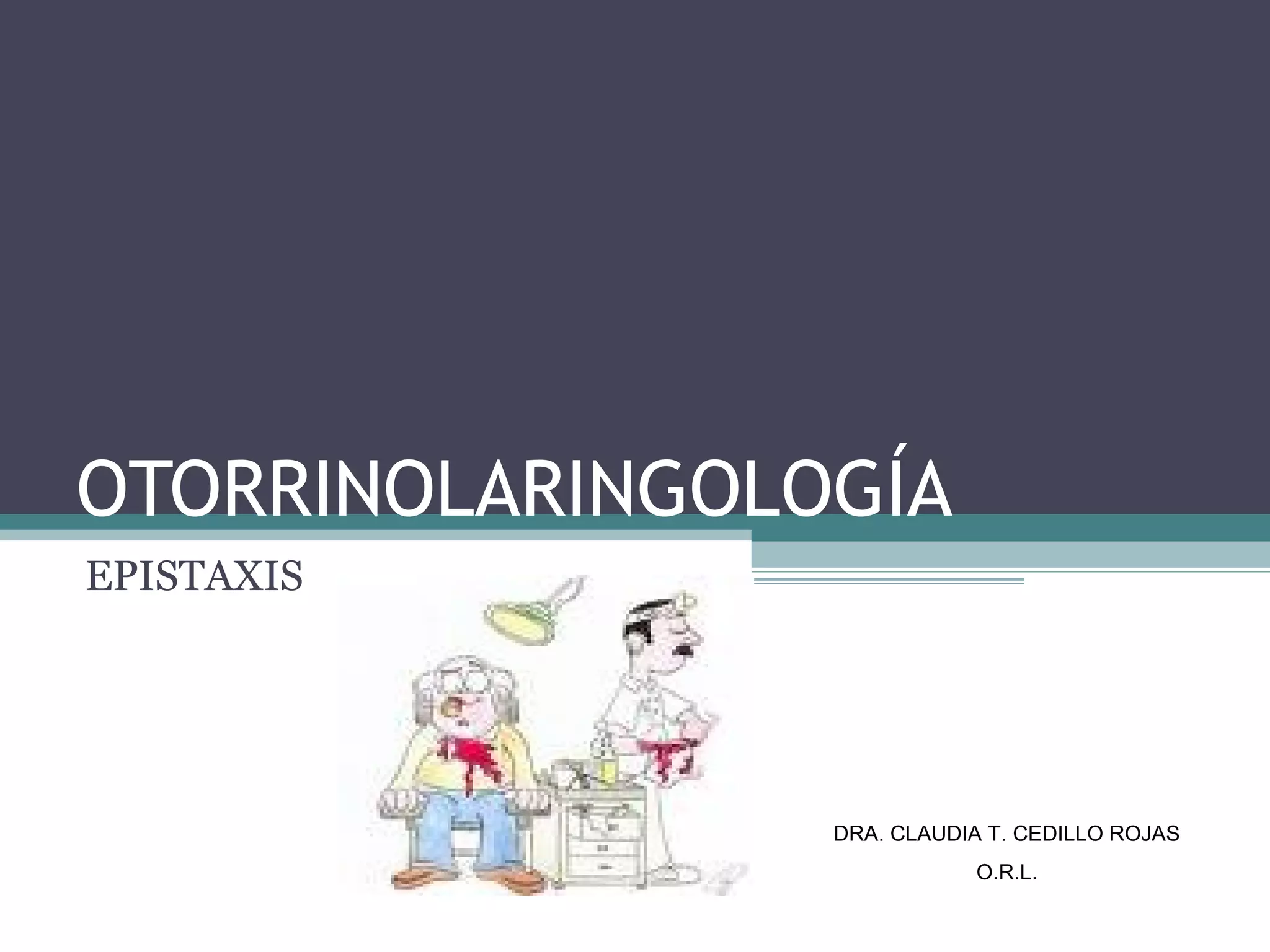 Epistaxis | PPT