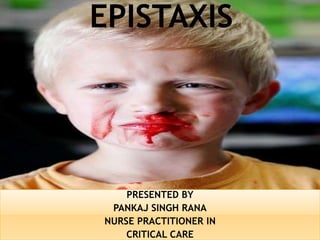 Epistaxis ( nose bleed) | PPTX