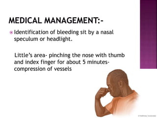 Epistaxis ( nose bleed) | PPTX