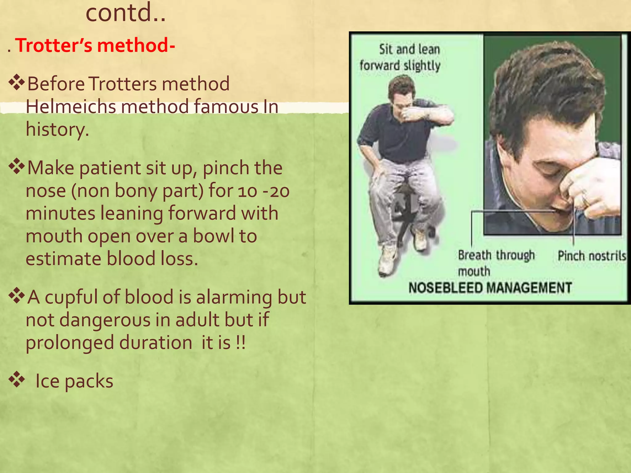 Epistaxis | PPTX