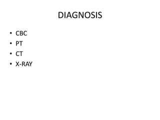 Epistaxis | PPTX