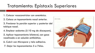 Epistaxis | PDF