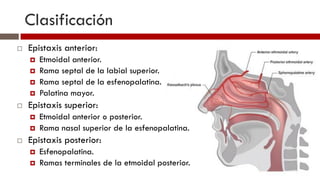 Epistaxis | PDF