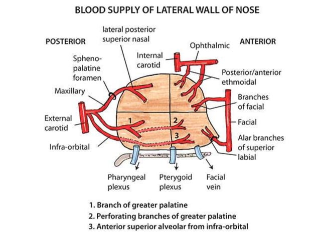Embolization for Epistaxis | PPT | First Aid | Injuries