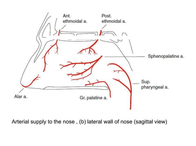 Embolization for Epistaxis | PPT | First Aid | Injuries