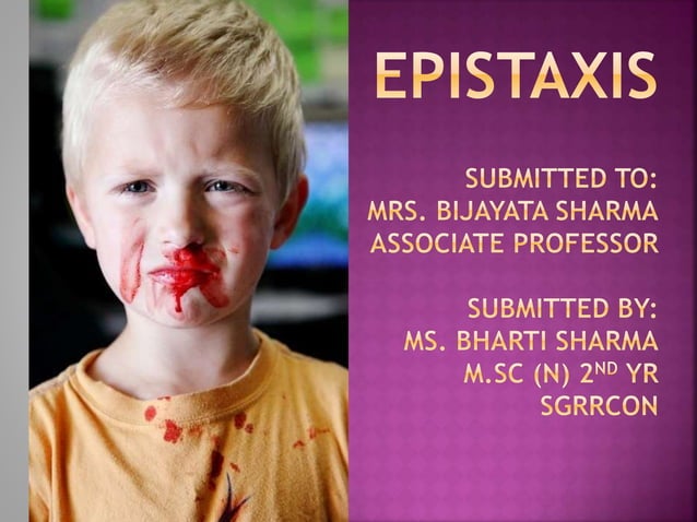 Epistaxis and its surgical and nursing management | PPTX | First Aid ...