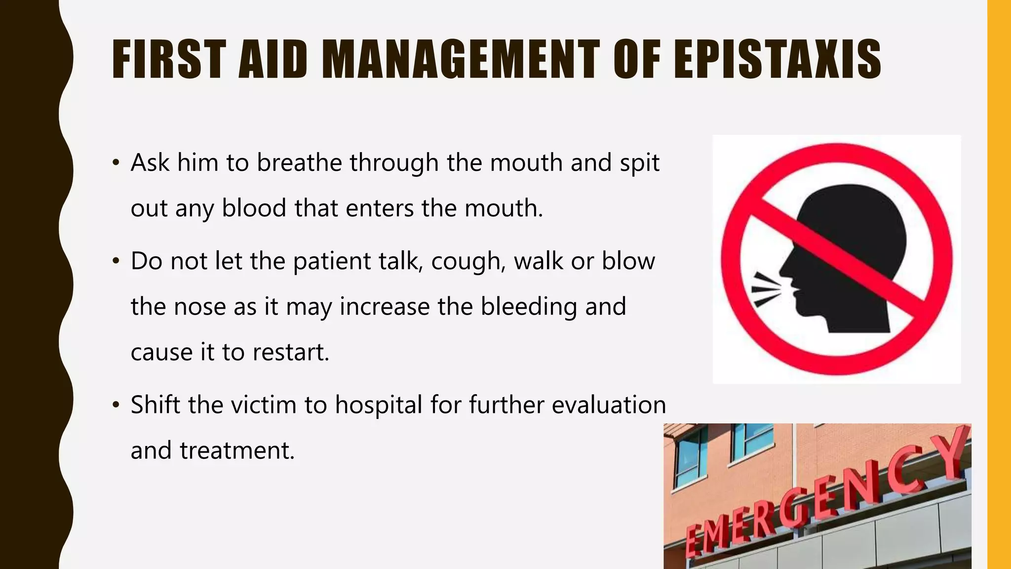 First aid for Epistaxis | PPTX