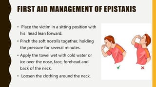 First aid for Epistaxis | PPTX