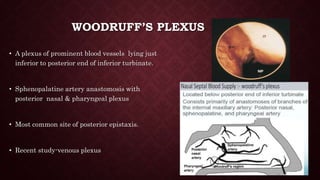 Epistaxis.pptx