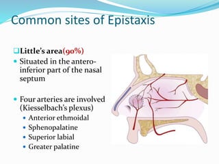 EPISTAXIS | PPTX