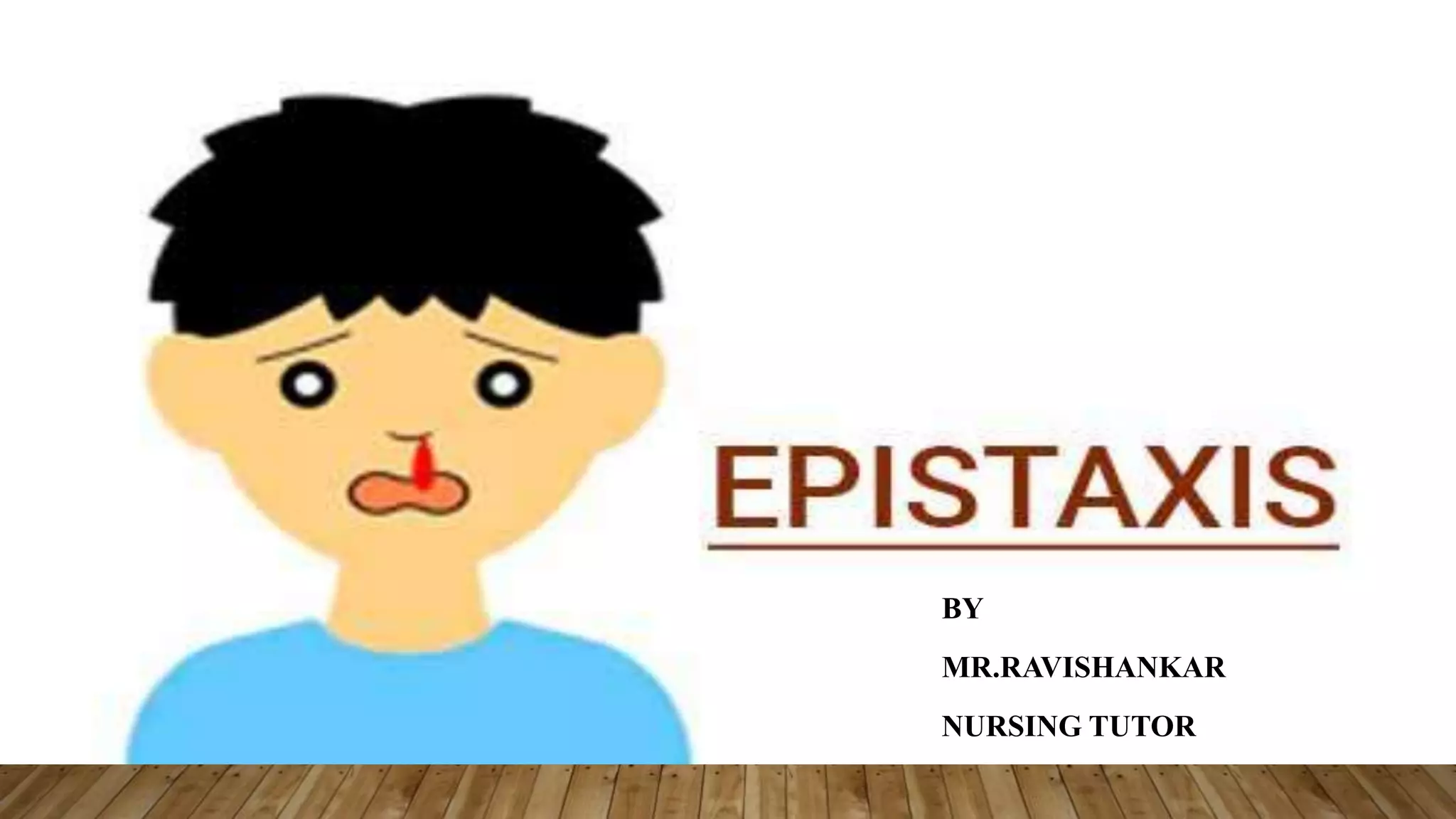Epistaxis.pptx