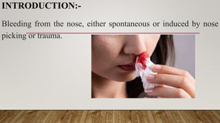 Epistaxis.pptx