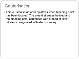 EPISTAXIS.pptx