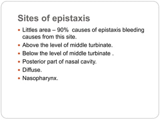 EPISTAXIS.pptx