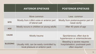 EPISTAXIS.pptx