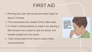 EPISTAXIS.pptx