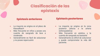 Epistaxis.pptx
