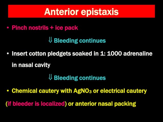 Epistaxis | PPT