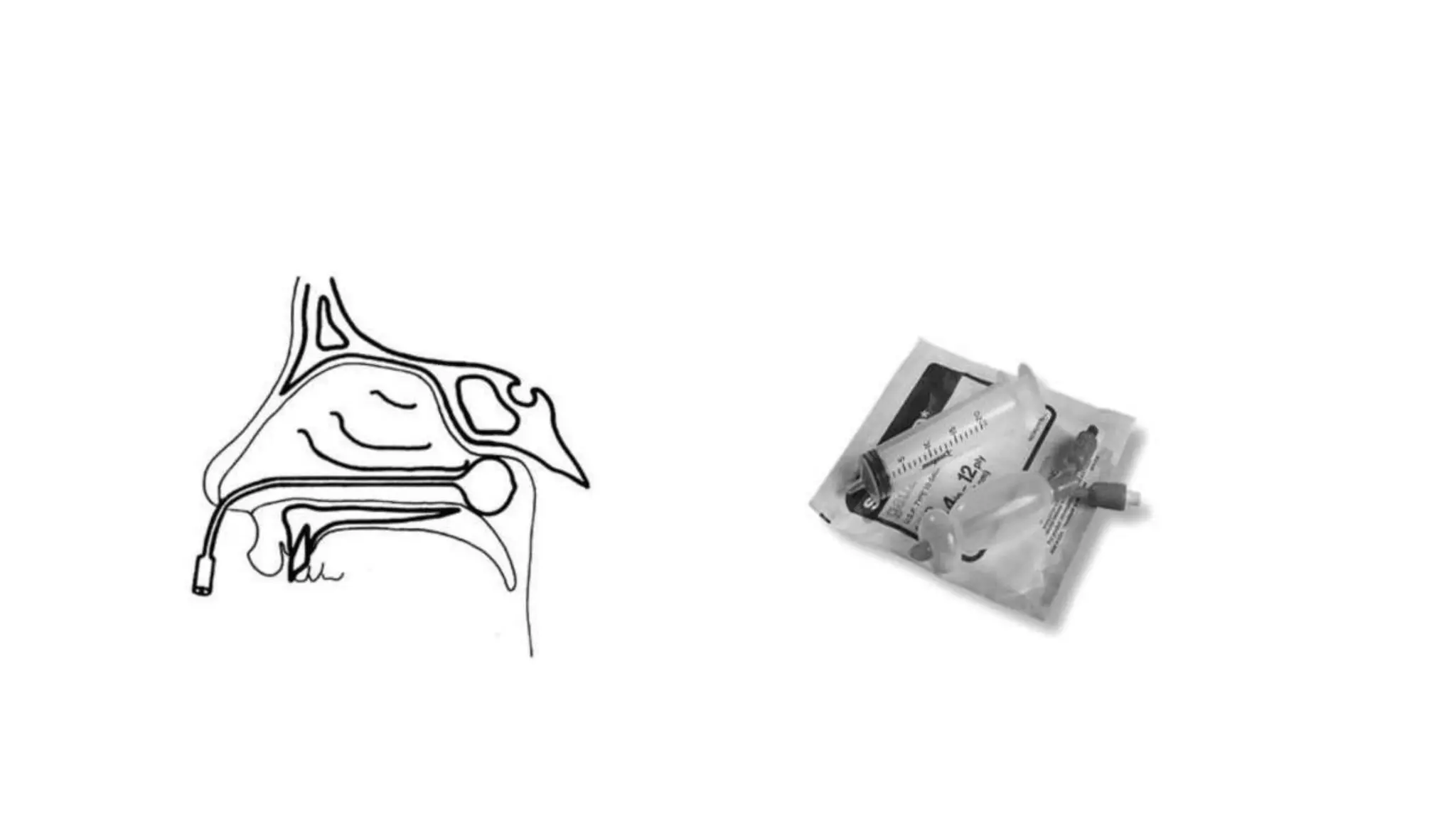 epistaxis.pptx