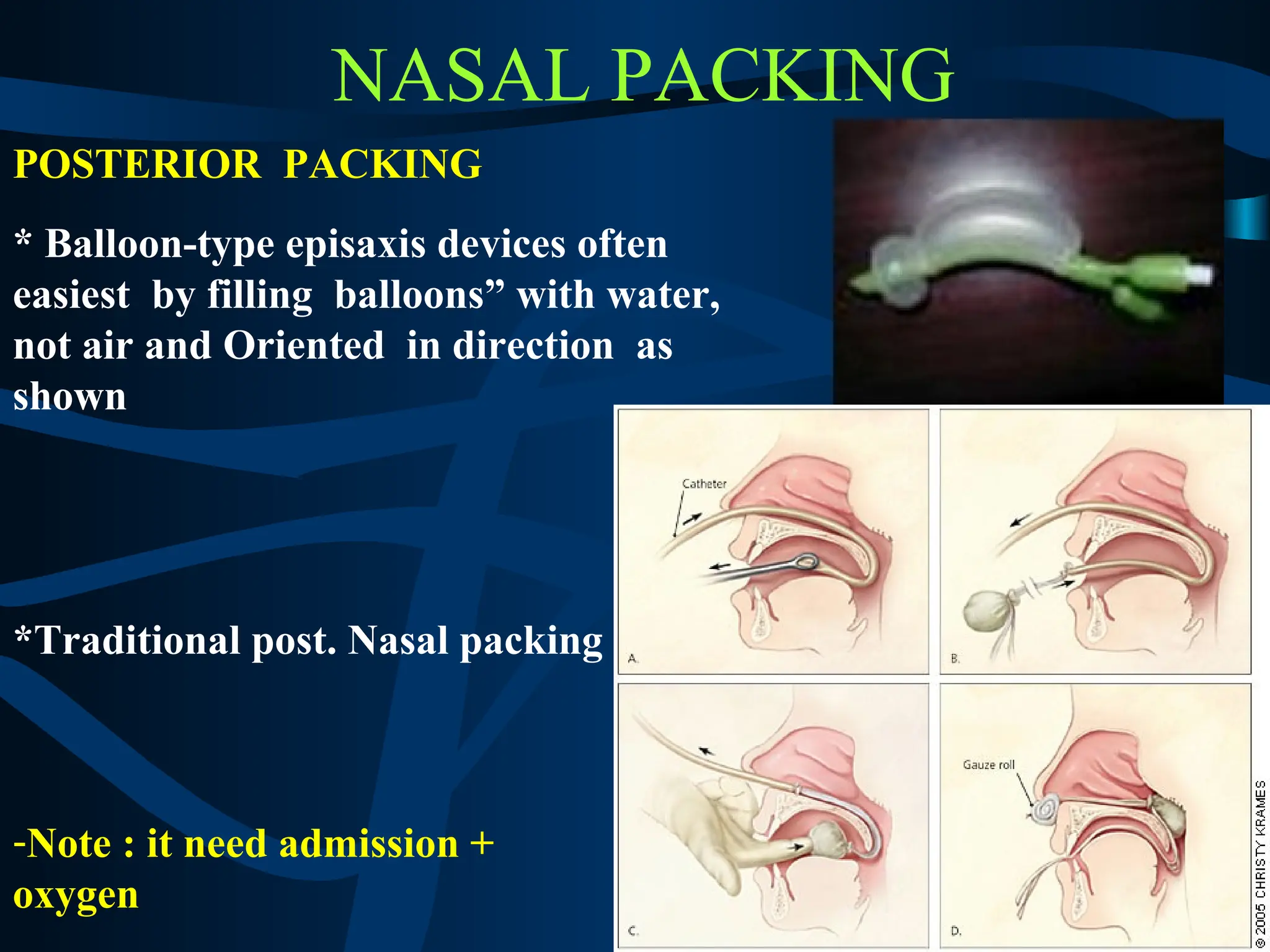 epistaxis.pdf | Ear, Nose and Throat Conditions | Diseases and Conditions