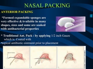epistaxis.pdf | Ear, Nose and Throat Conditions | Diseases and Conditions