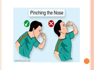 epistaxis.pptxslidesharethankyousomuchii | PPTX | First Aid | Injuries