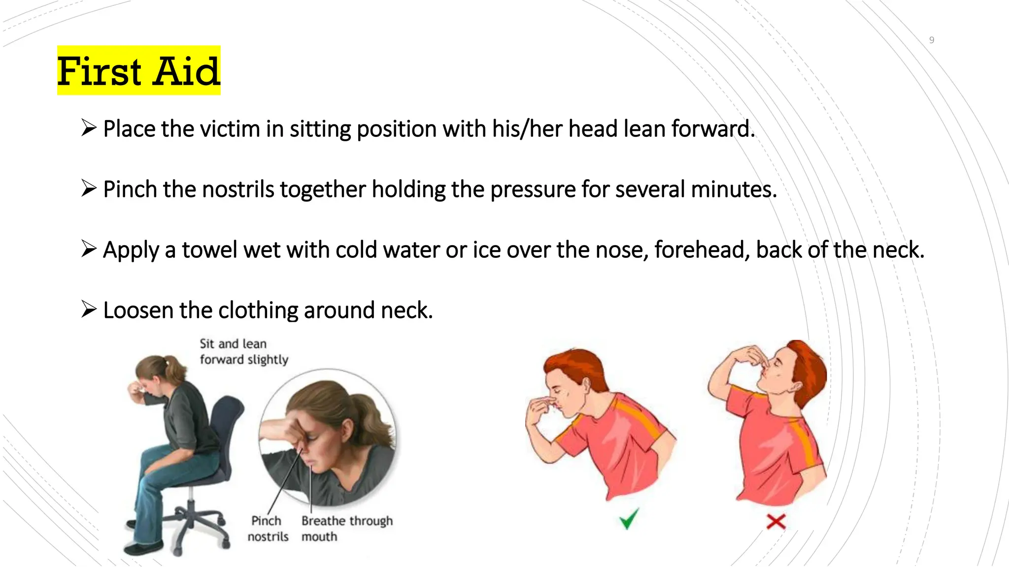 Everything about Epistaxis (nasal bleeding) .pdf