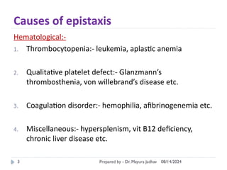Epistaxis.pptx bleeding through nose know the treatment | PPT