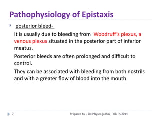 Epistaxis.pptx bleeding through nose know the treatment | PPT