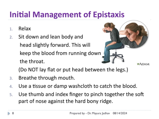 Epistaxis.pptx bleeding through nose know the treatment | PPT