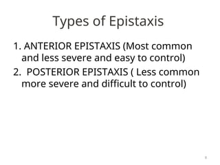 Epistaxis ( Nose Bleeding ) .ppt