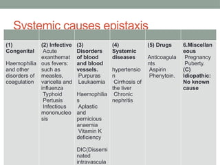 Epistaxis nasal bleeding undergraduate lecture | PPTX